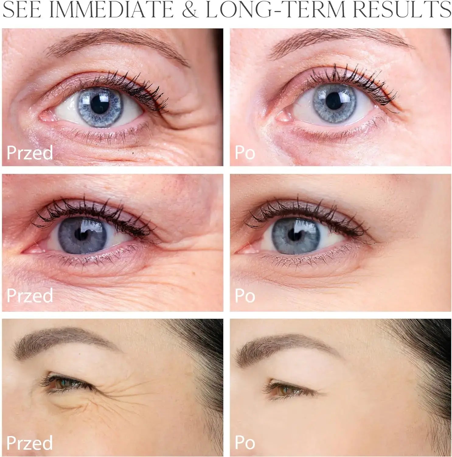 Krem pod oczy z Retinolem + Maska BOTOX w Prezencie – AzjaSklep